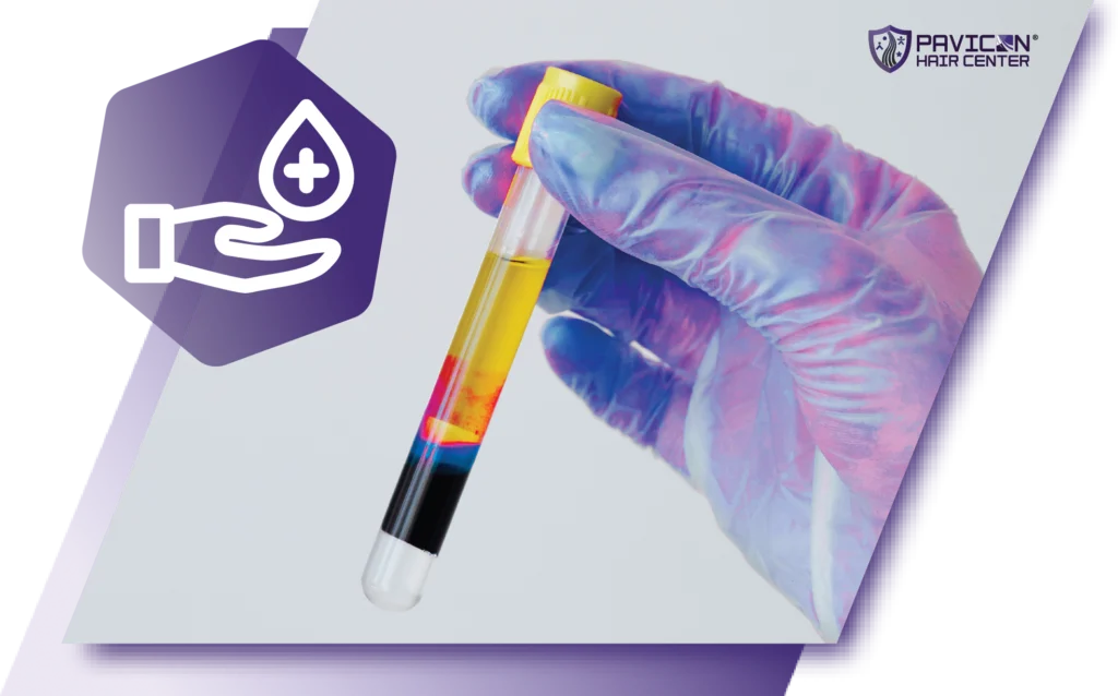 Plasma Hair PRP - paviconclinic.com